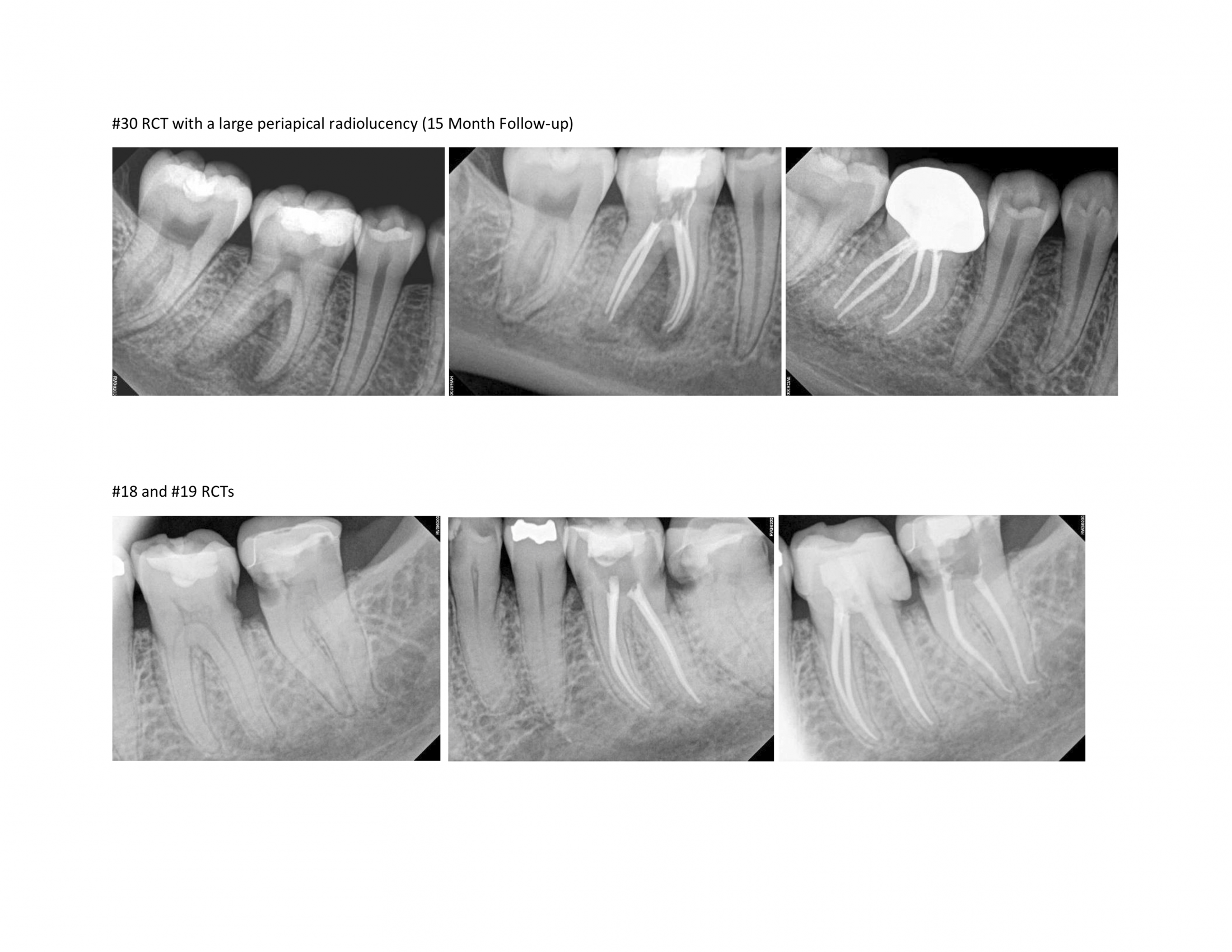 Dr. Kim's Case Studies Las Vegas NV, Red Rock Endodontics